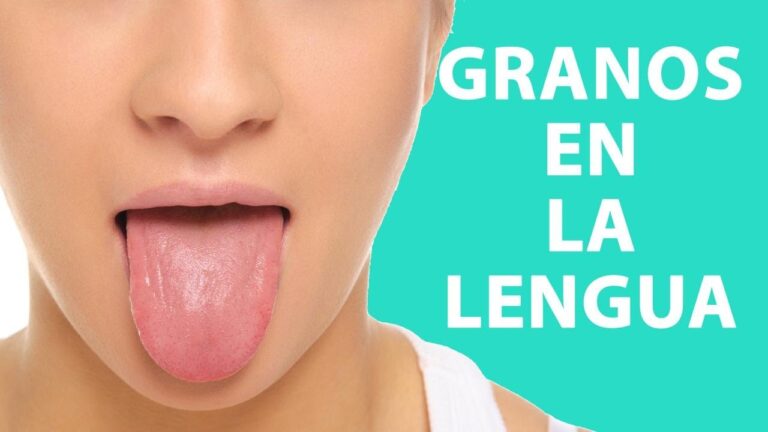 Las Causas de los Granos en la Lengua y Cómo Tratarlos: Guía Completa ...