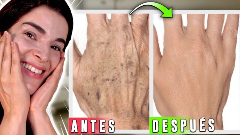 Remedios Caseros Efectivos para Manos Secas: Soluciones Naturales que ...